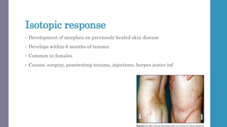 Morphea and allied Sclerosing Inflammatory Dermatoses-1.pptx