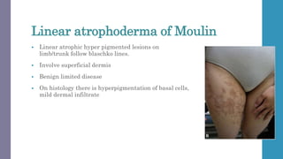 Morphea and allied Sclerosing Inflammatory Dermatoses-1.pptx