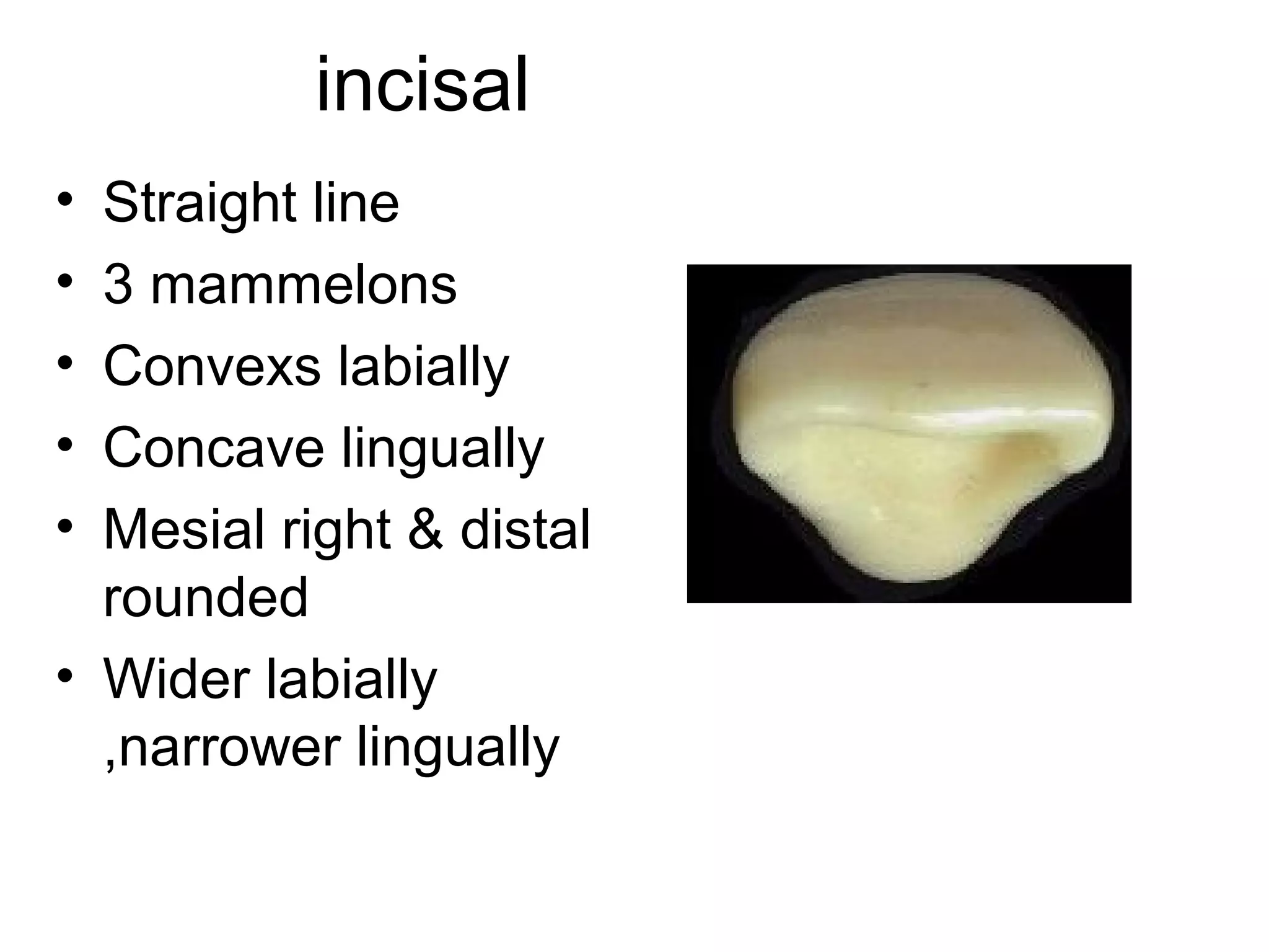 tooth Morphology central incisor | PPT