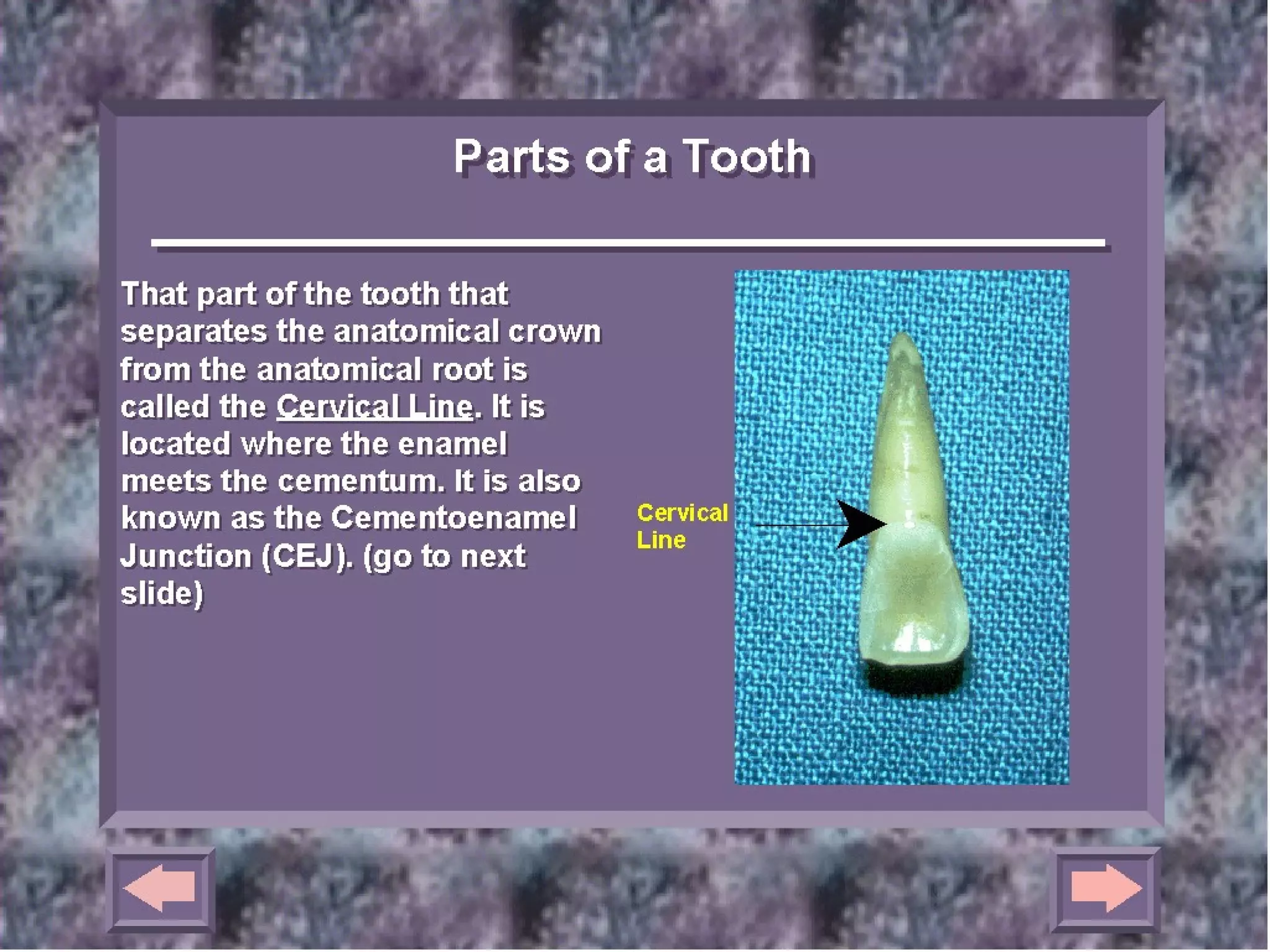 tooth Morphology central incisor | PPT