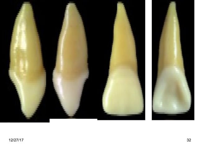 tooth Morphology central incisor | PPT