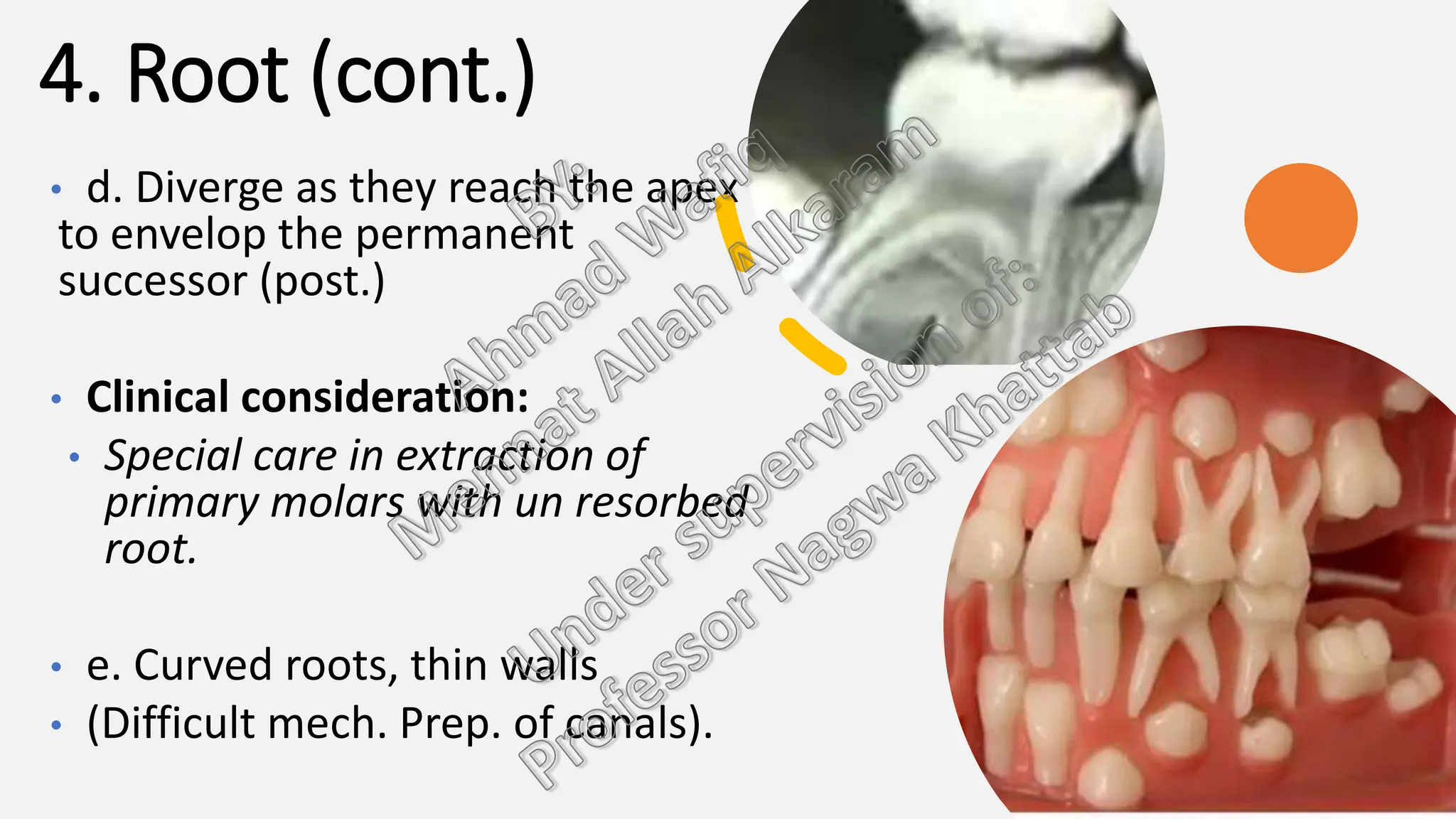Morphological differences between permanent and deciduous teeth.pptx