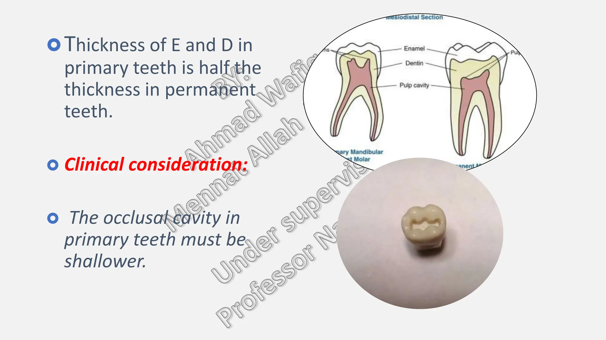 Morphological differences between permanent and deciduous teeth.pptx