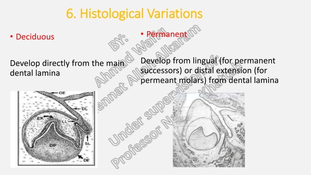 Morphological differences between permanent and deciduous teeth.pptx