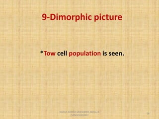 Morphological abnormality of red blood cell | PDF
