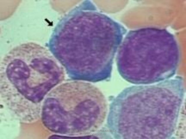 Morphological abnormality of red blood cell | PDF