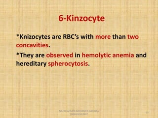 Morphological abnormality of red blood cell | PPT