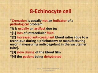 Echinocytes And Crenation