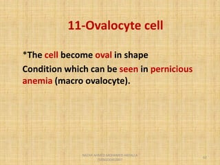 Ovalocyte