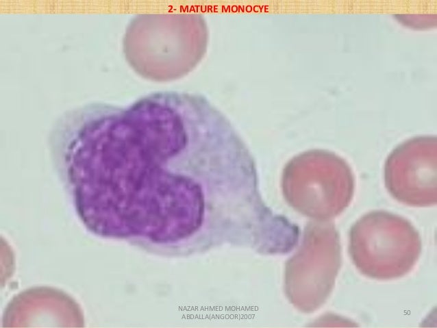 Morphological abnormality of white blood cell