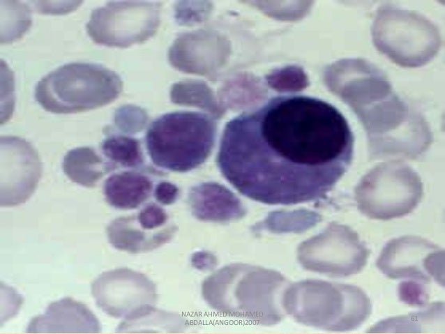 Morphological abnormality of white blood cell