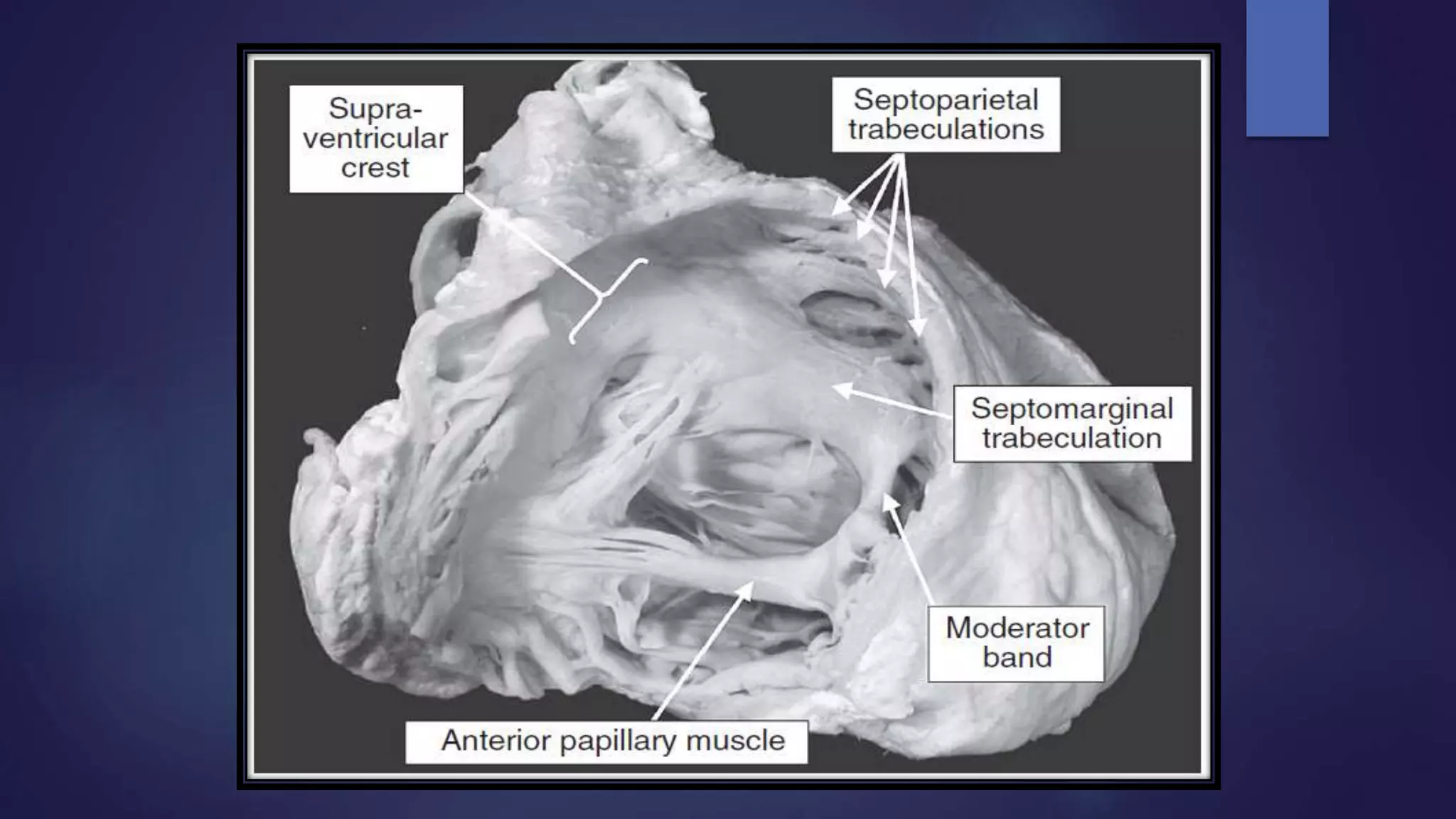 Morphological anatomy of heart | PPTX