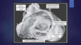 Supraventricular Crest