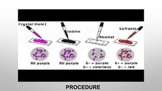 Gram Staining | PPTX