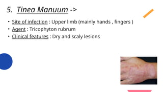 Morphological Classification Of Dermatophytes.pptx
