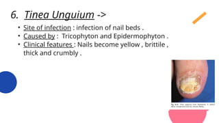 Morphological Classification Of Dermatophytes.pptx
