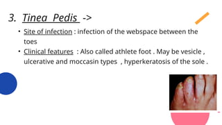 Morphological Classification Of Dermatophytes.pptx