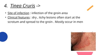 Morphological Classification Of Dermatophytes.pptx