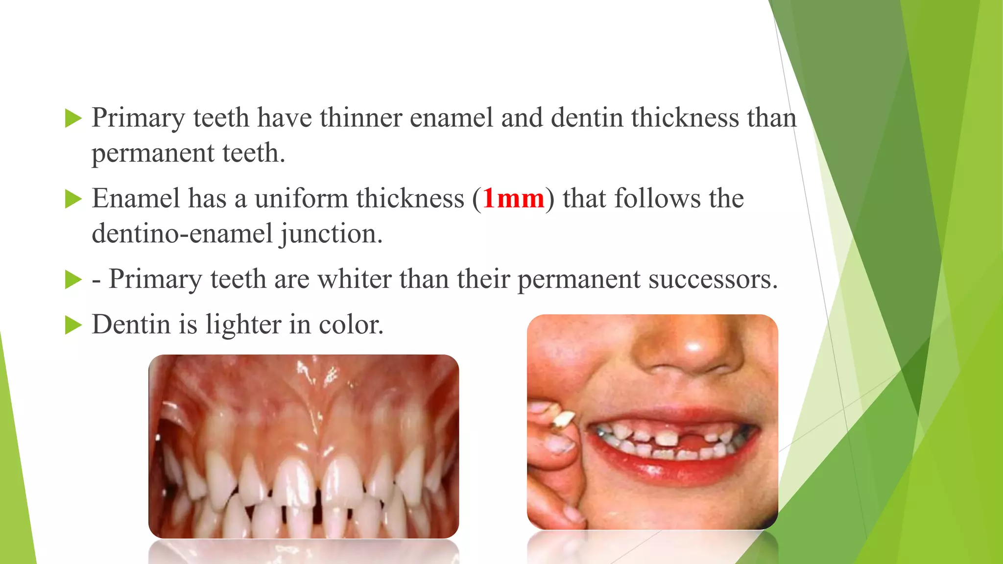 Morphological Differences Between Primary And Permanent Teeth 2016.pptx