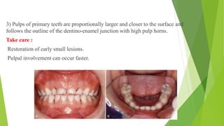 Morphological Differences Between Primary And Permanent Teeth 2016.pptx