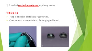 Morphological Differences Between Primary And Permanent Teeth 2016.pptx