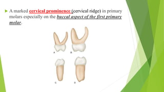 Morphological Differences Between Primary And Permanent Teeth 2016.pptx