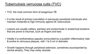 Morphological features of tuberculosis | PPTX