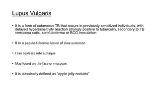 Morphological features of tuberculosis | PPTX