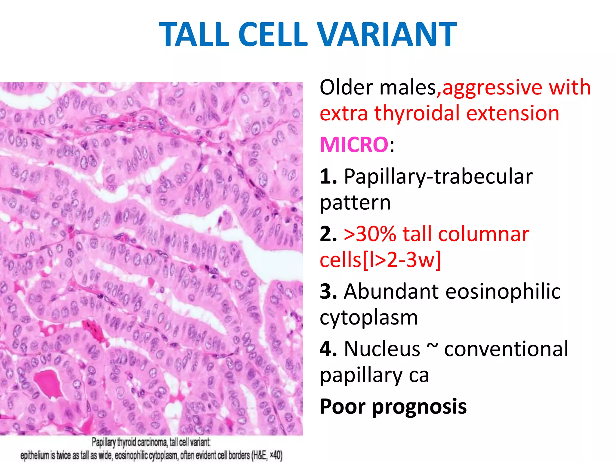 Morphological spectrum of malignant thyroid neoplasm | PPTX
