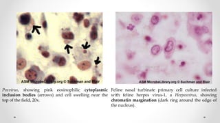 Morphologic changes in viral infections | PPTX
