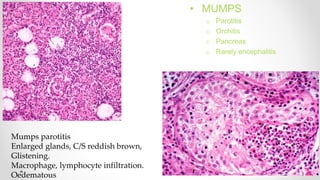 Morphologic changes in viral infections | PPTX