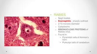 Morphologic changes in viral infections | PPTX