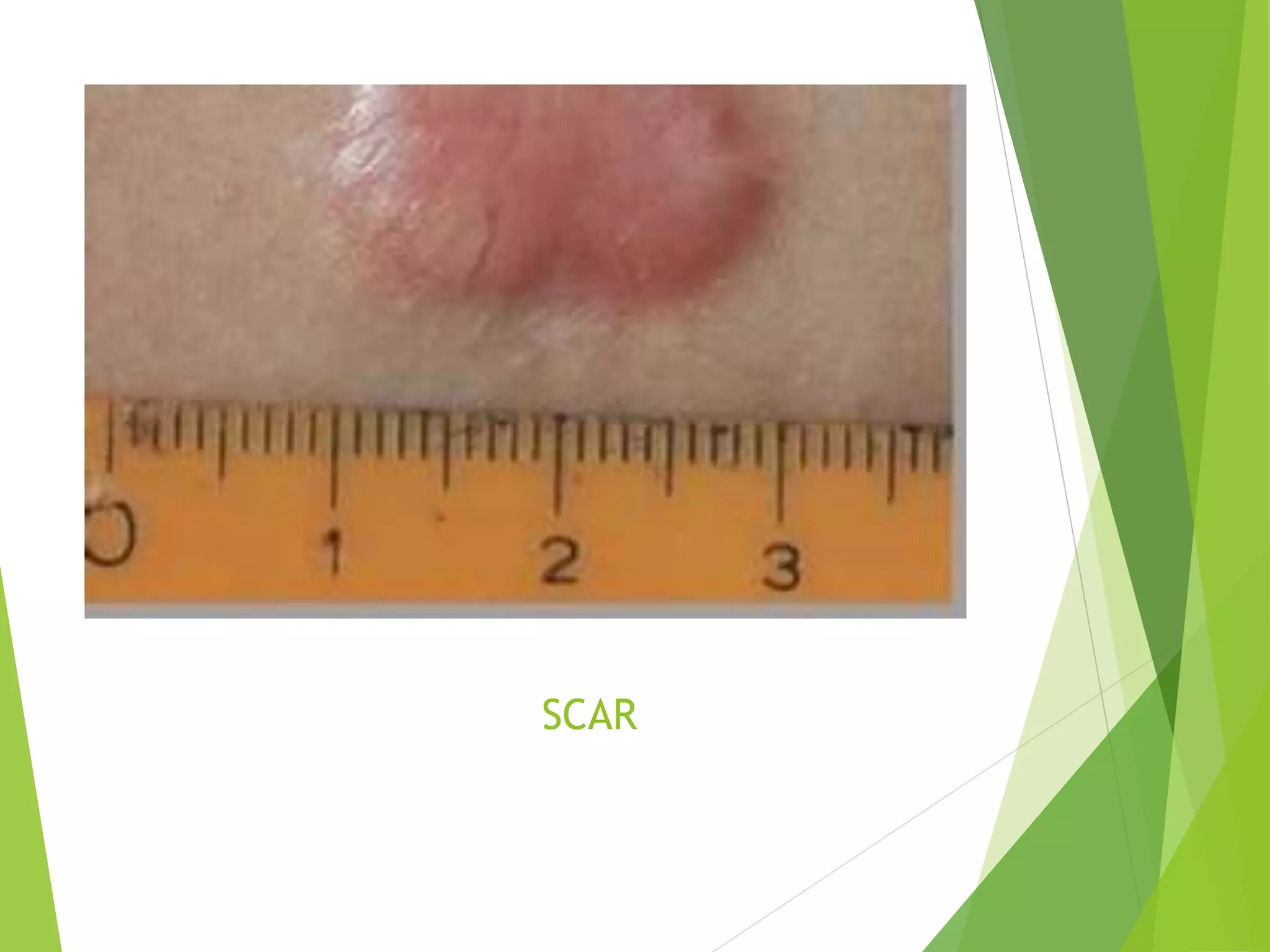 Morphologic skin lesions | PPTX