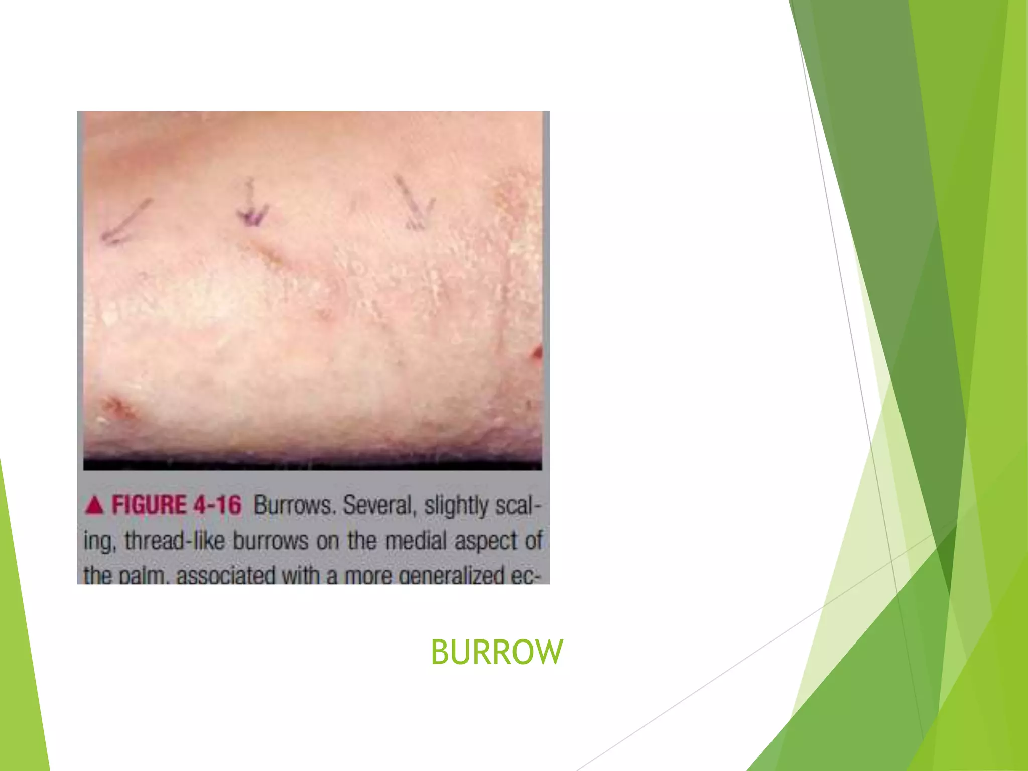 Morphologic skin lesions | PPTX