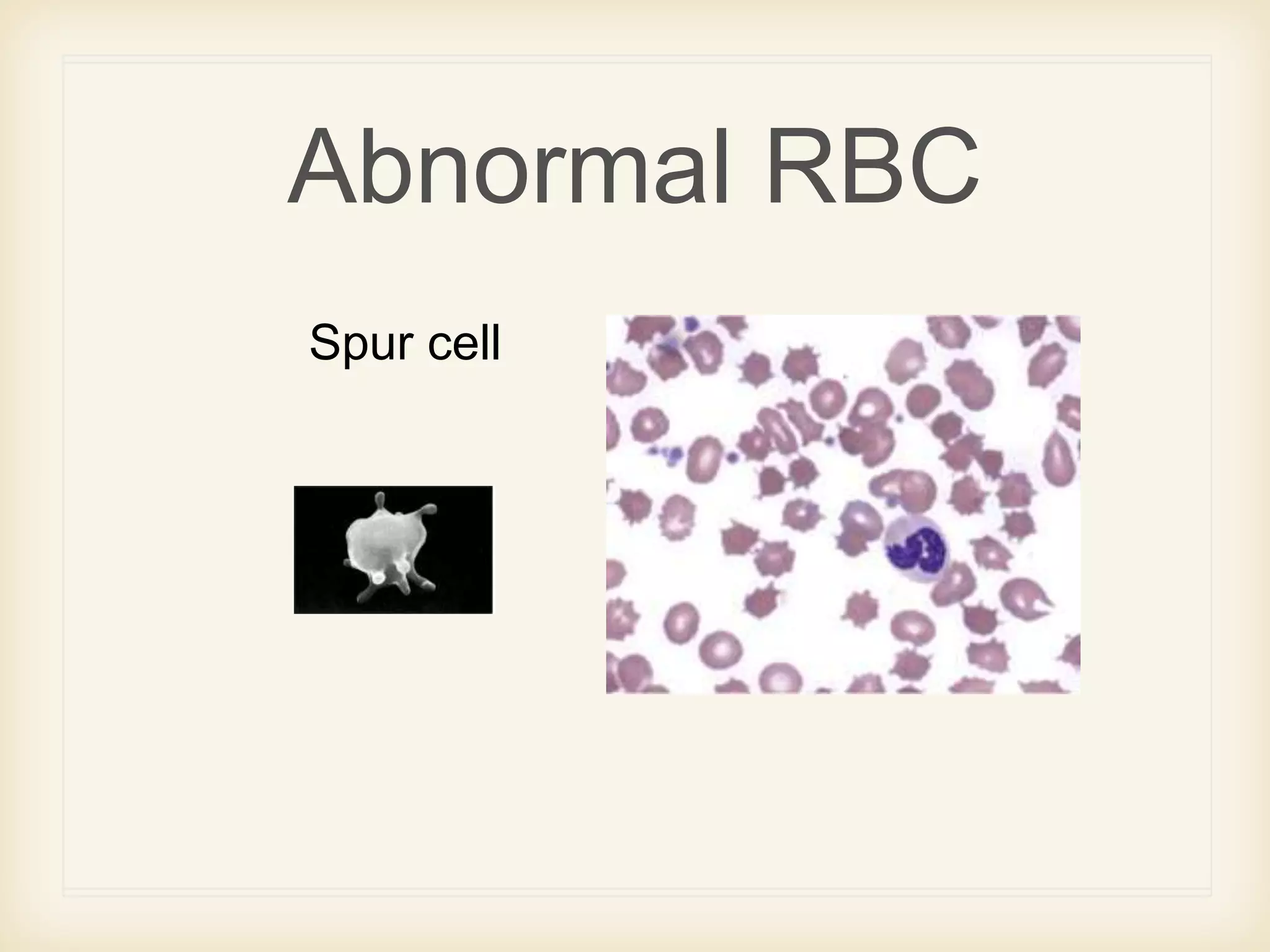 Blood smear morphology | PPTX