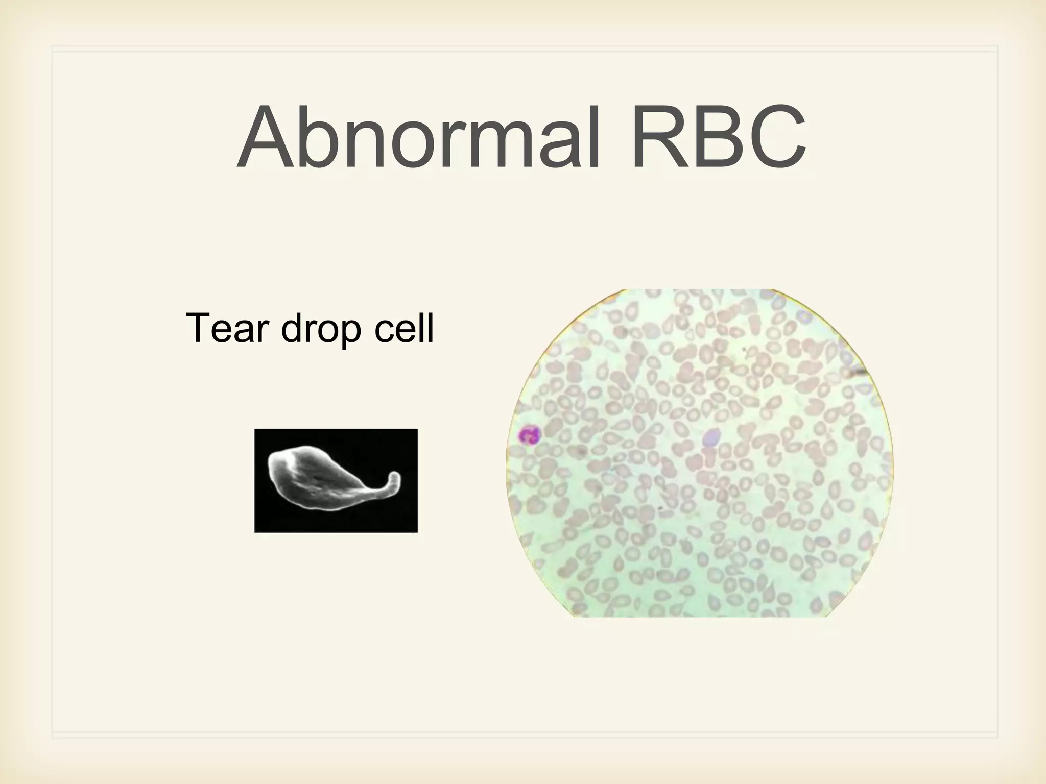Blood smear morphology | PPTX