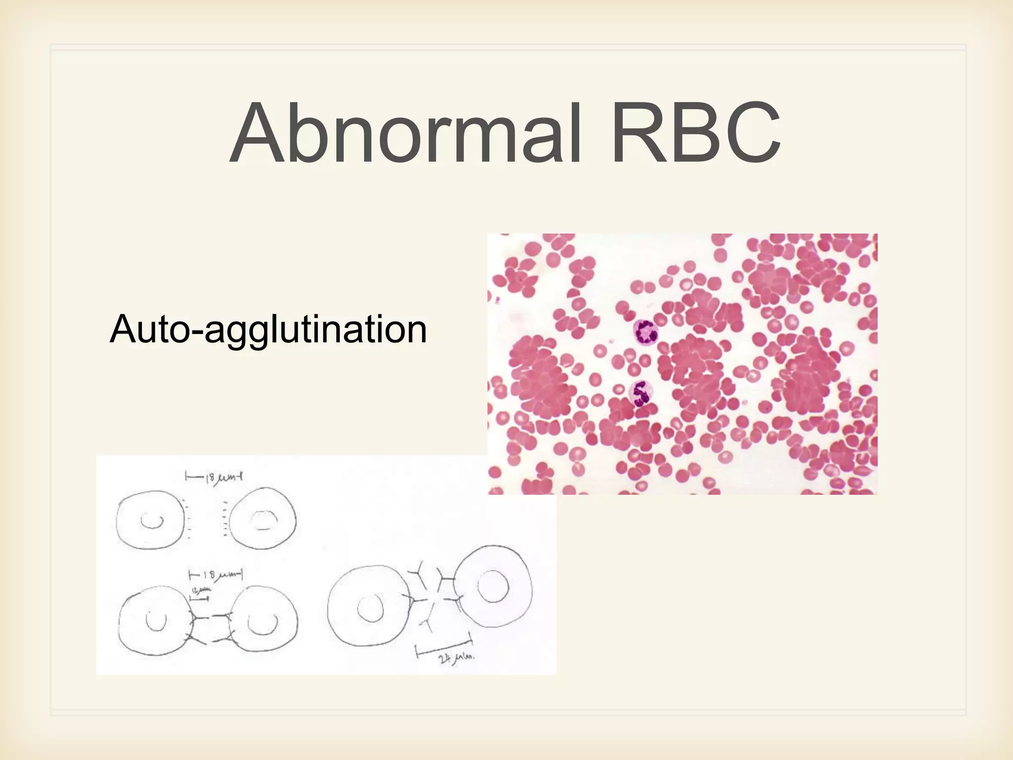 Blood smear morphology | PPTX
