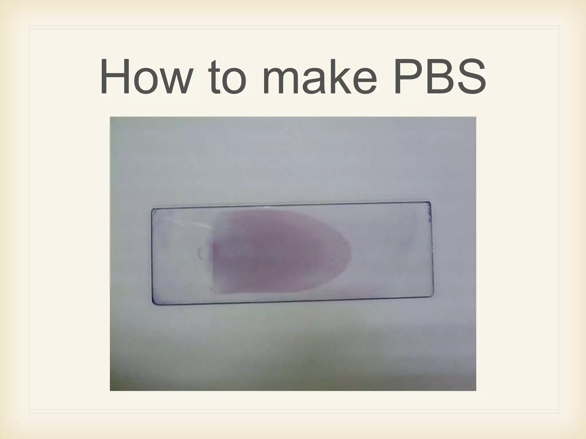 Blood smear morphology