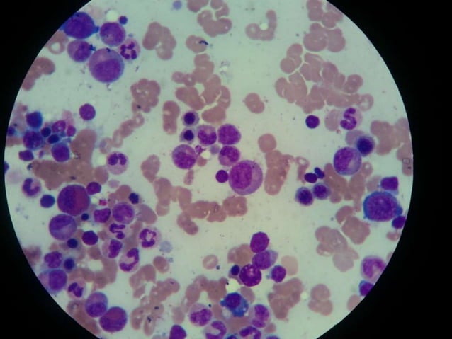 Blood smear morphology | PPTX | Blood Disorders | Diseases and Conditions