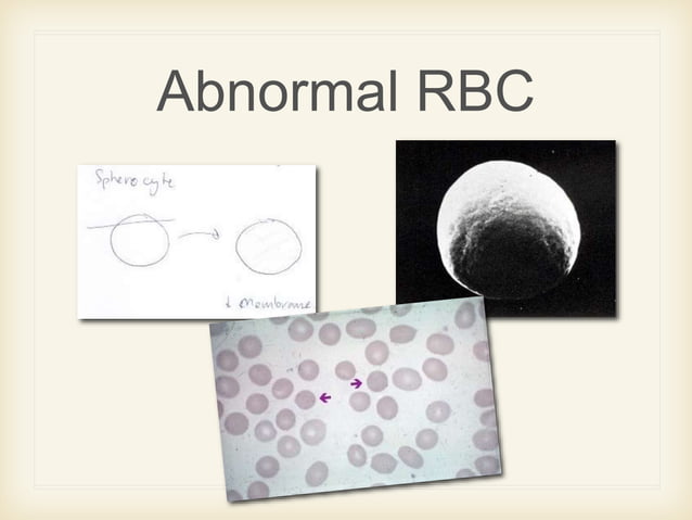 Blood smear morphology | PPTX | Blood Disorders | Diseases and Conditions