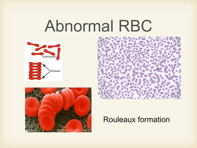 Blood smear morphology | PPTX | Blood Disorders | Diseases and Conditions