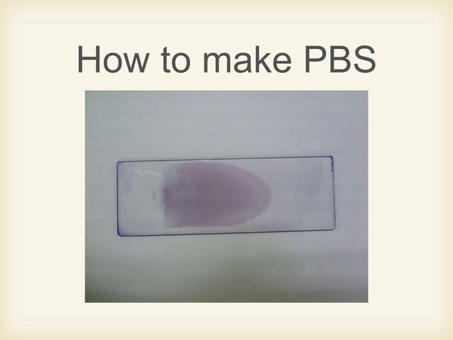 Blood smear morphology | PPTX | Blood Disorders | Diseases and Conditions
