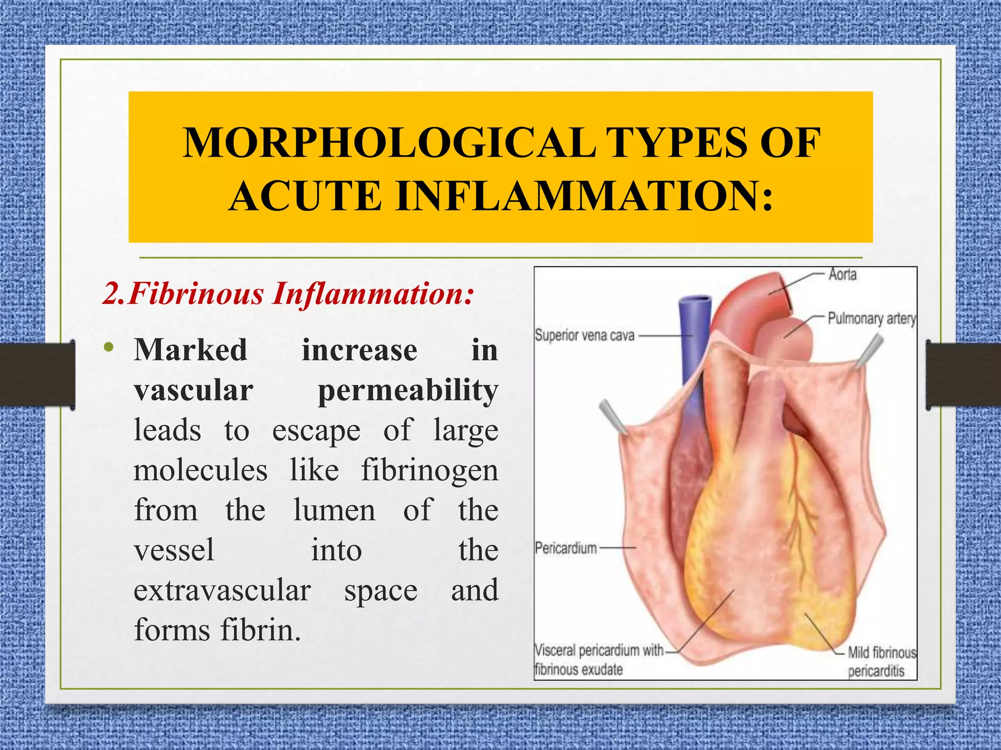 Morphology of-acute-inflammation | PPT