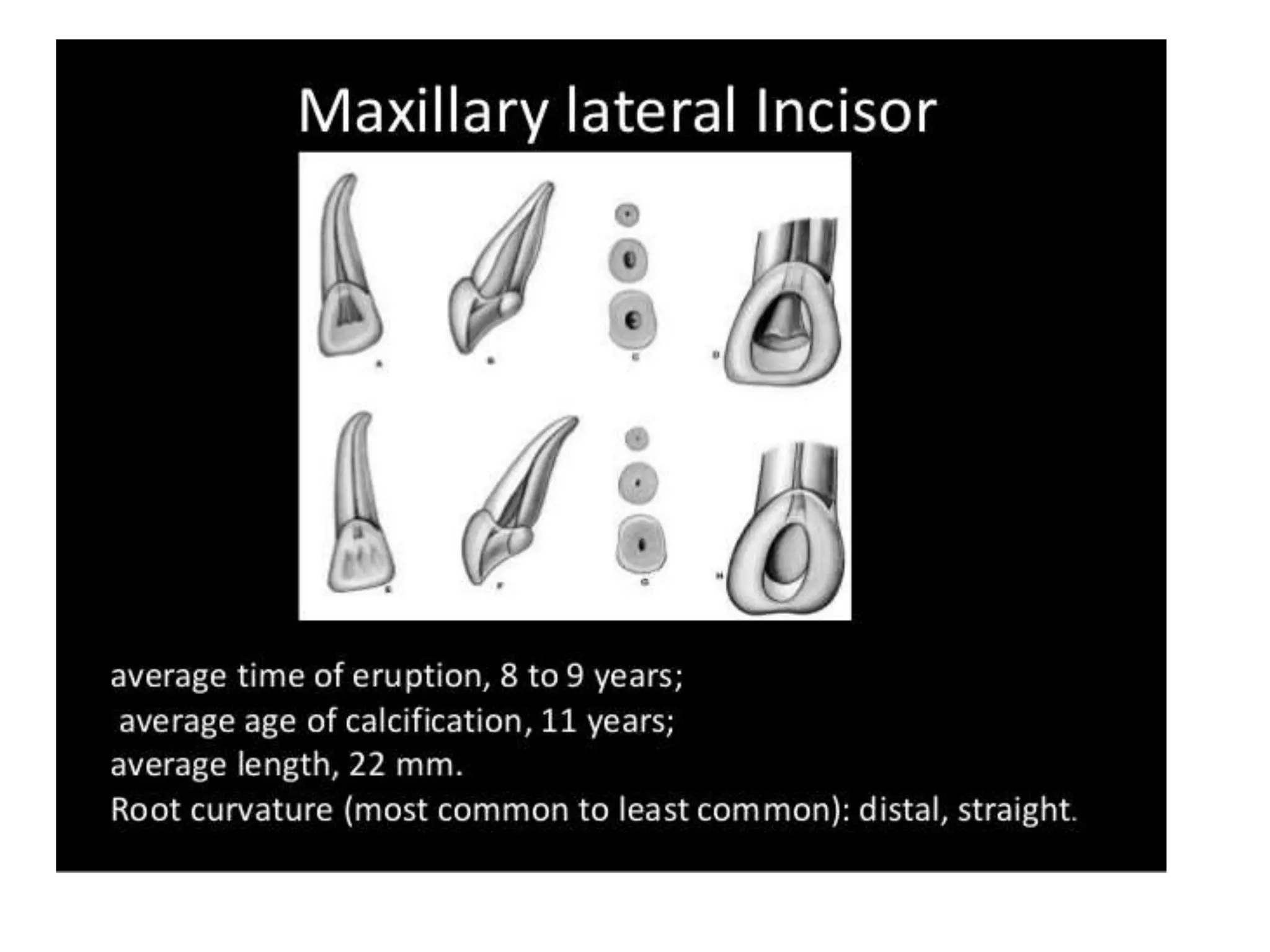 Morphology And Internal Anatomy Of Root Canal System Ppt