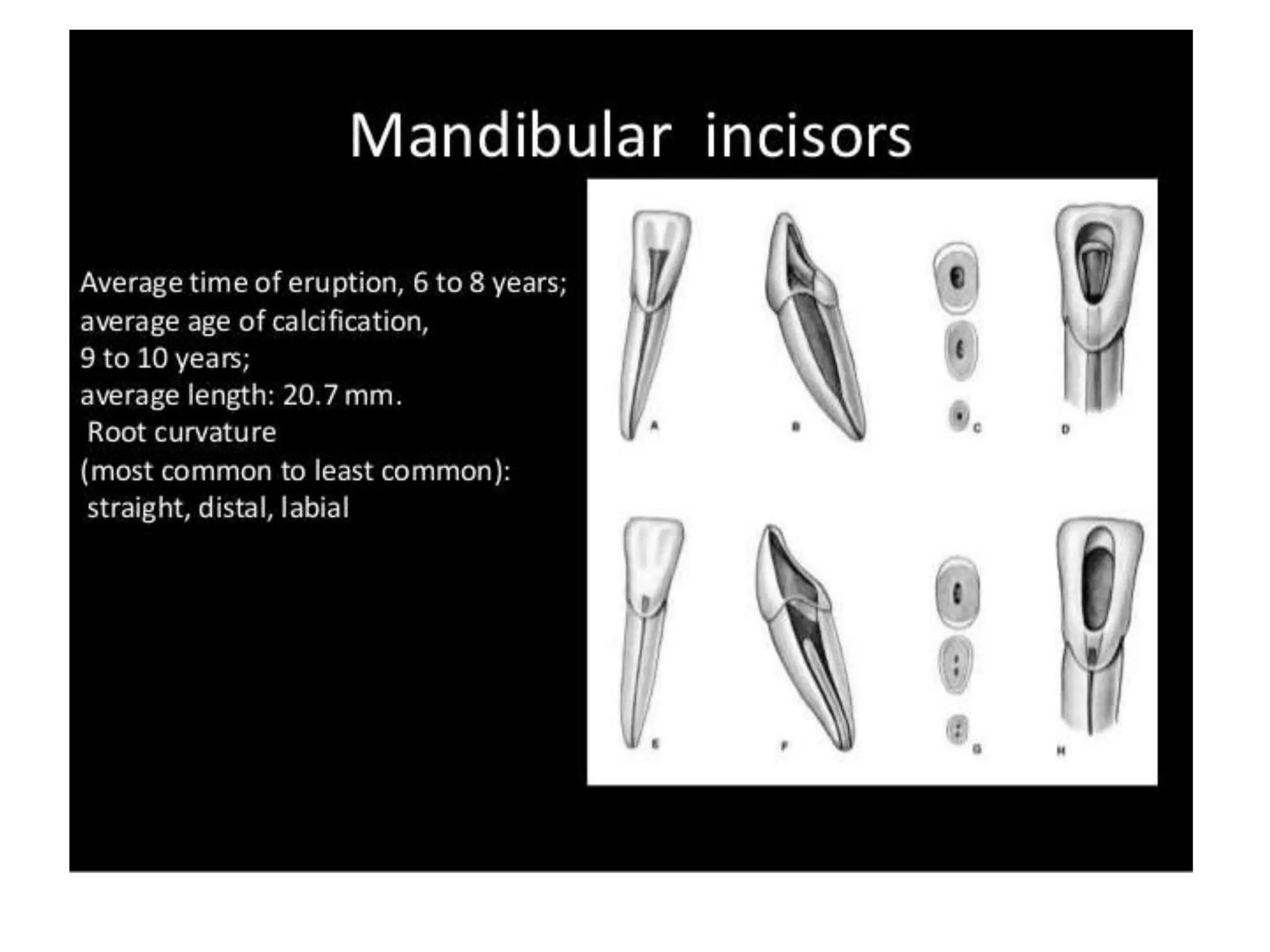 Morphology And Internal Anatomy Of Root Canal System Ppt