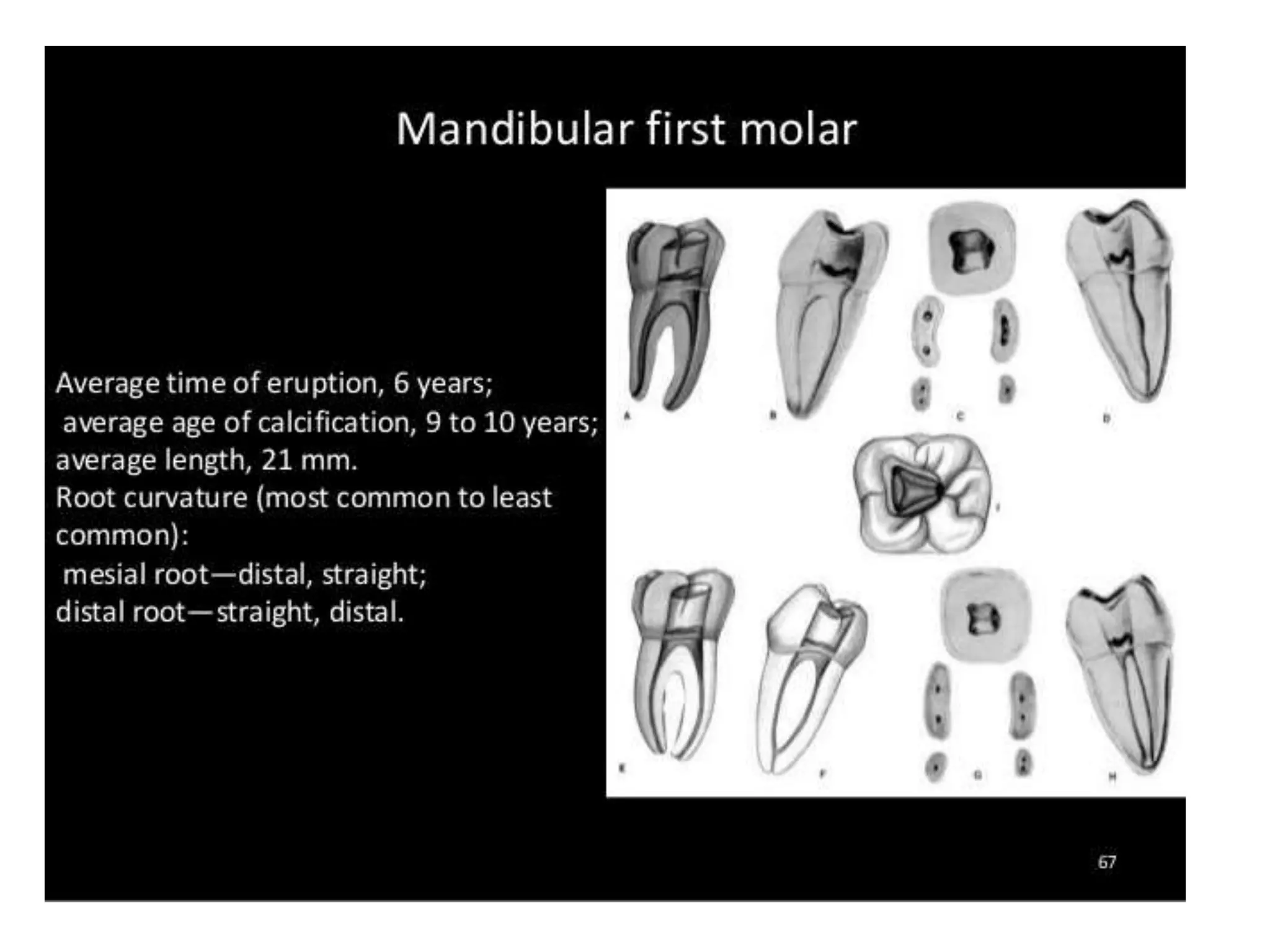 Morphology And Internal Anatomy Of Root Canal System Ppt