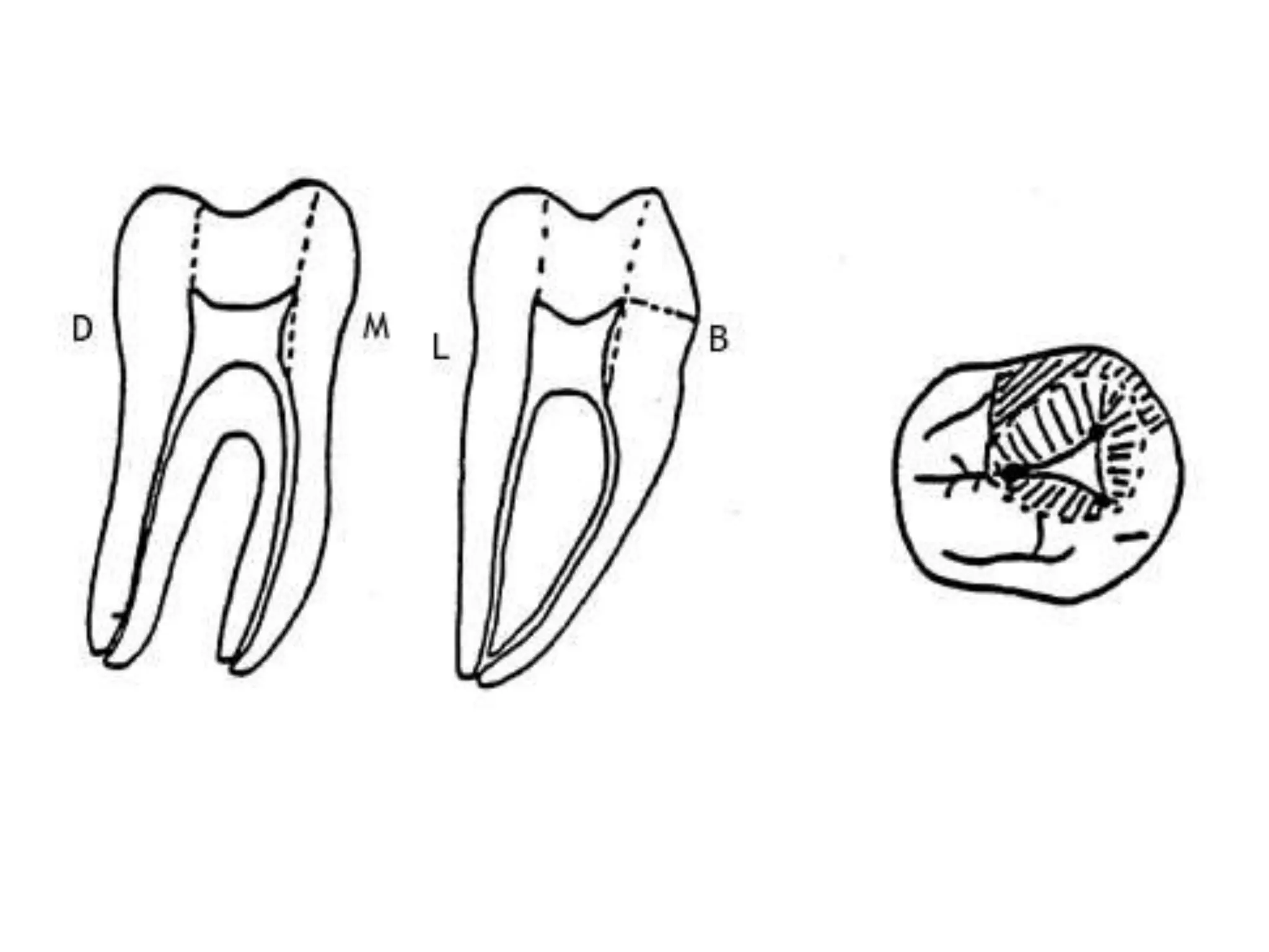 Morphology And Internal Anatomy Of Root Canal System Ppt