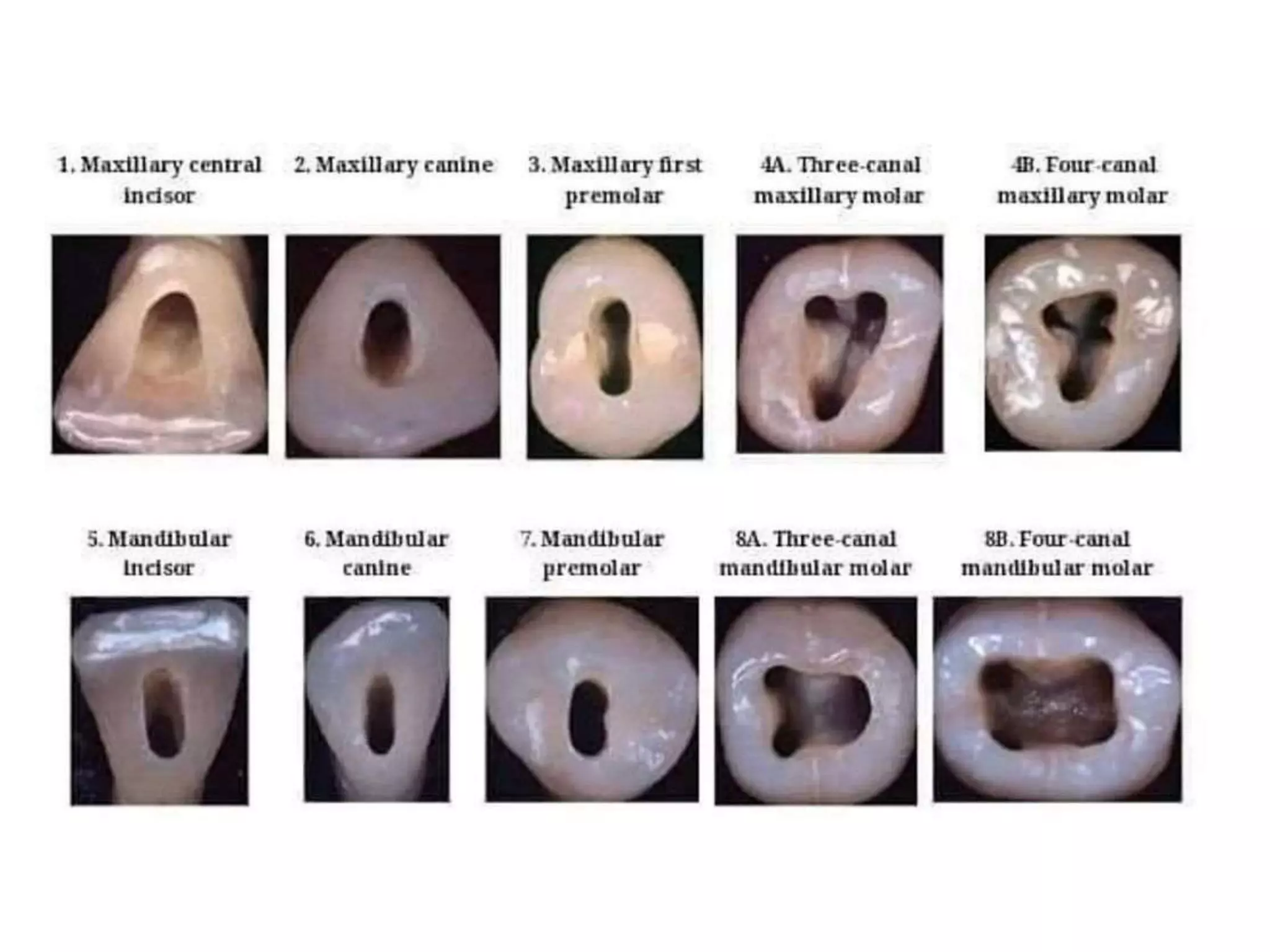 Morphology And Internal Anatomy Of Root Canal System Ppt