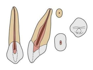 Morphology and internal anatomy of root canal system | PPTX