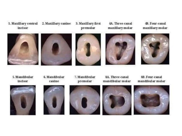 Morphology and internal anatomy of root canal system | PPTX